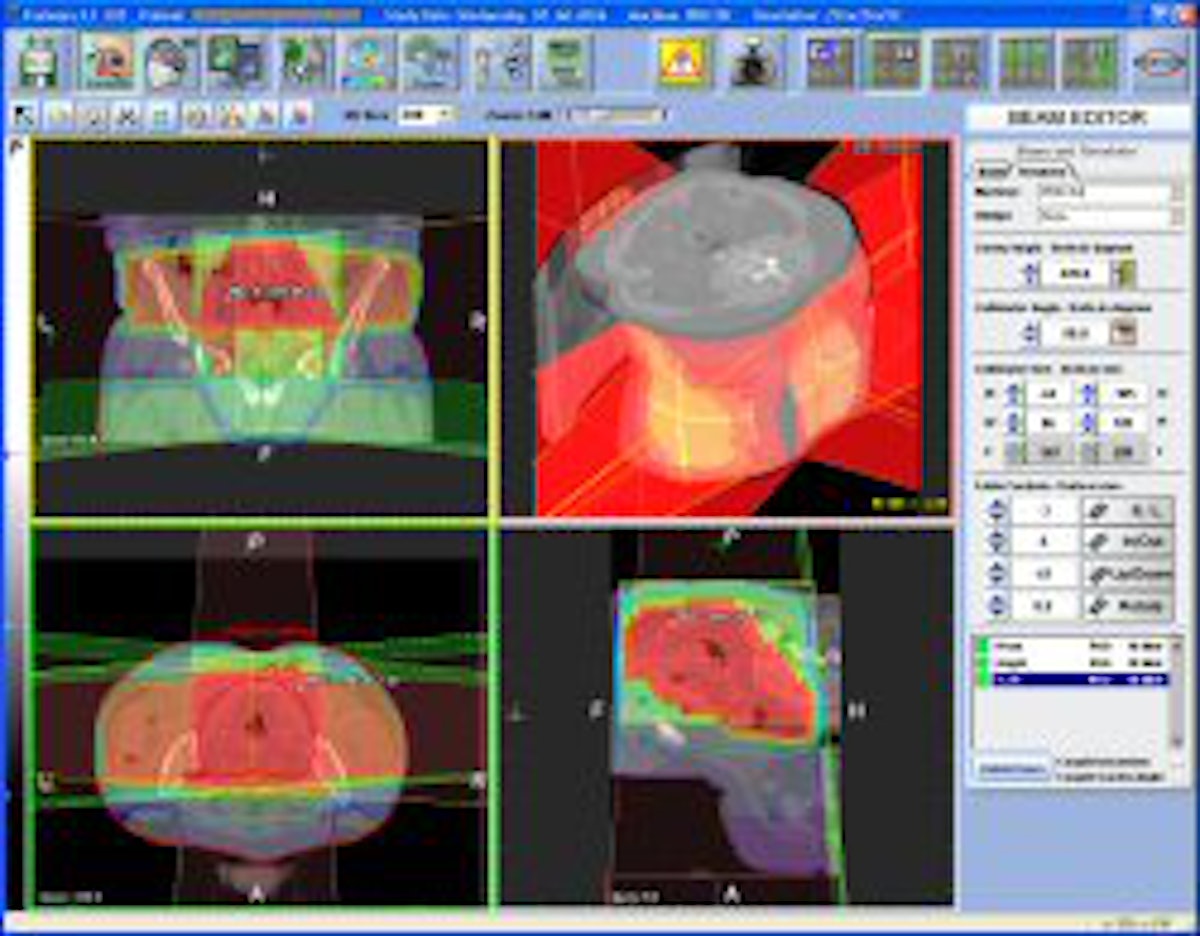 NetMeeting software aids oncologist/radiologist collaboration ...
