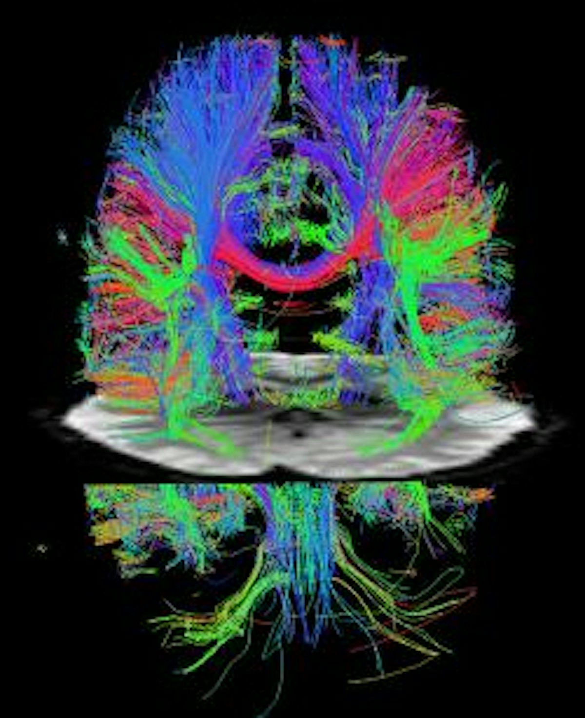Advance in MRI allows faster brain scans | AuntMinnieEurope