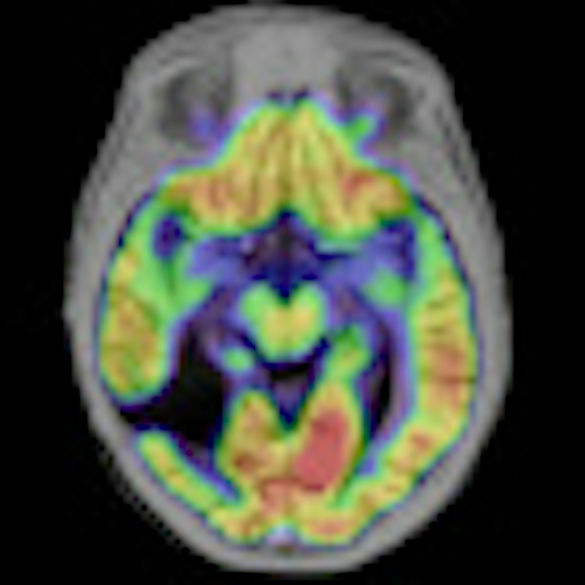 MRI errors occur most often in spine and brain, U.K. study finds ...
