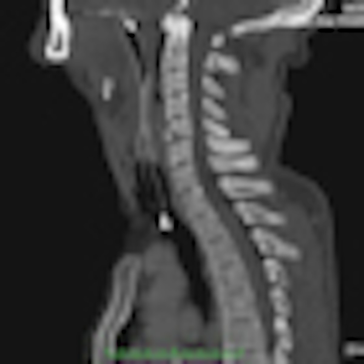 CT makes world of difference in battlefield imaging | AuntMinnieEurope