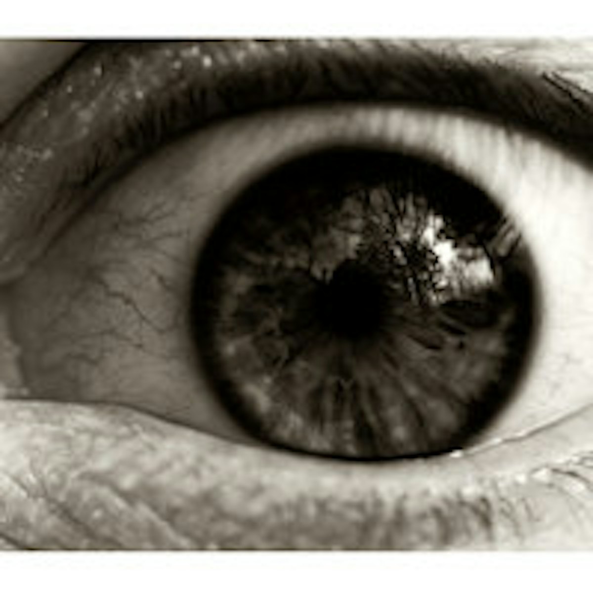 Out of sight: CT know-how proves vital in orbital trauma | AuntMinnieEurope