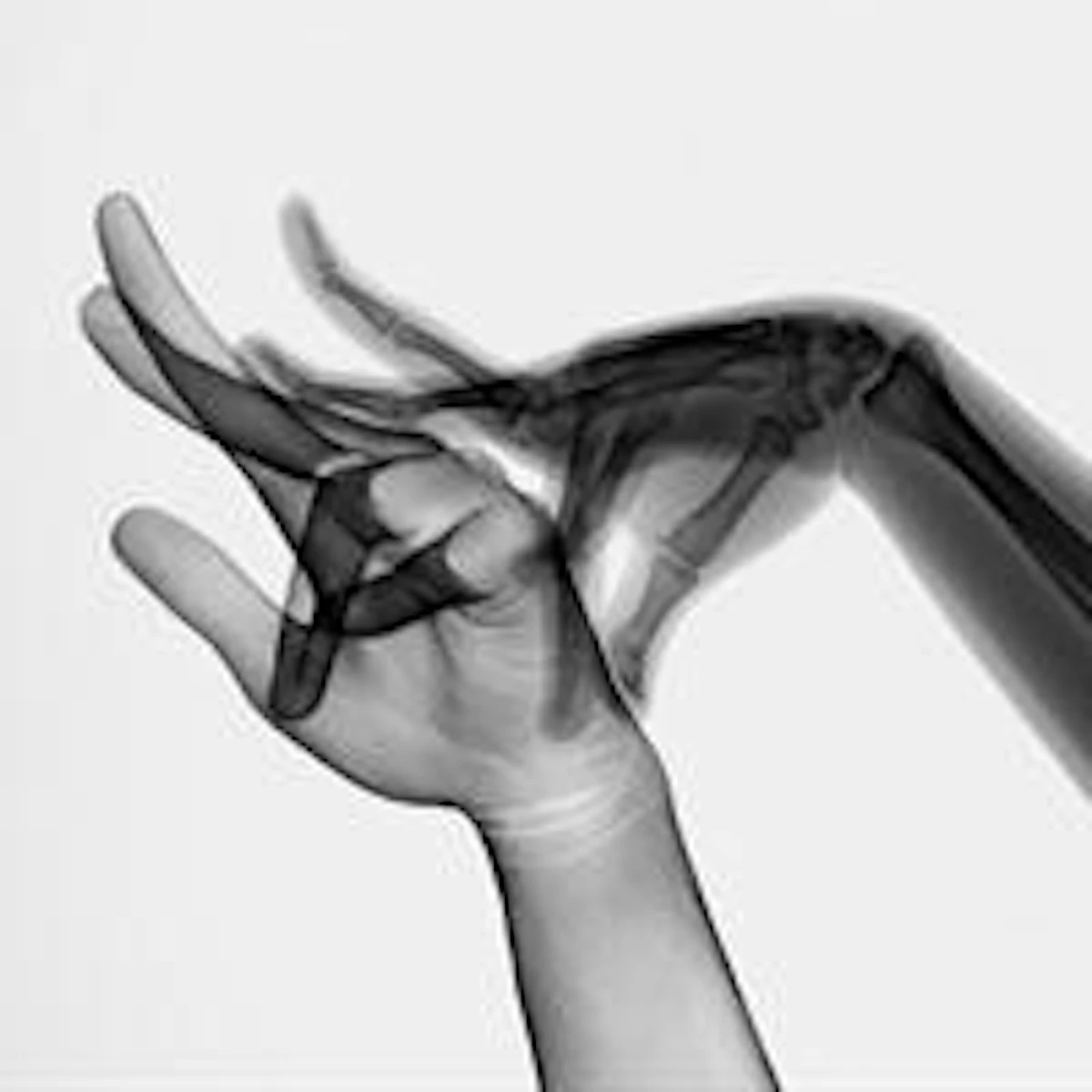 Hand x-ray art project gets slap on the wrist | AuntMinnieEurope