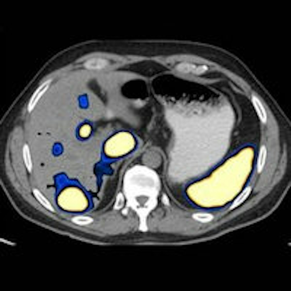 How molecular techniques can transform abdominal oncology ...