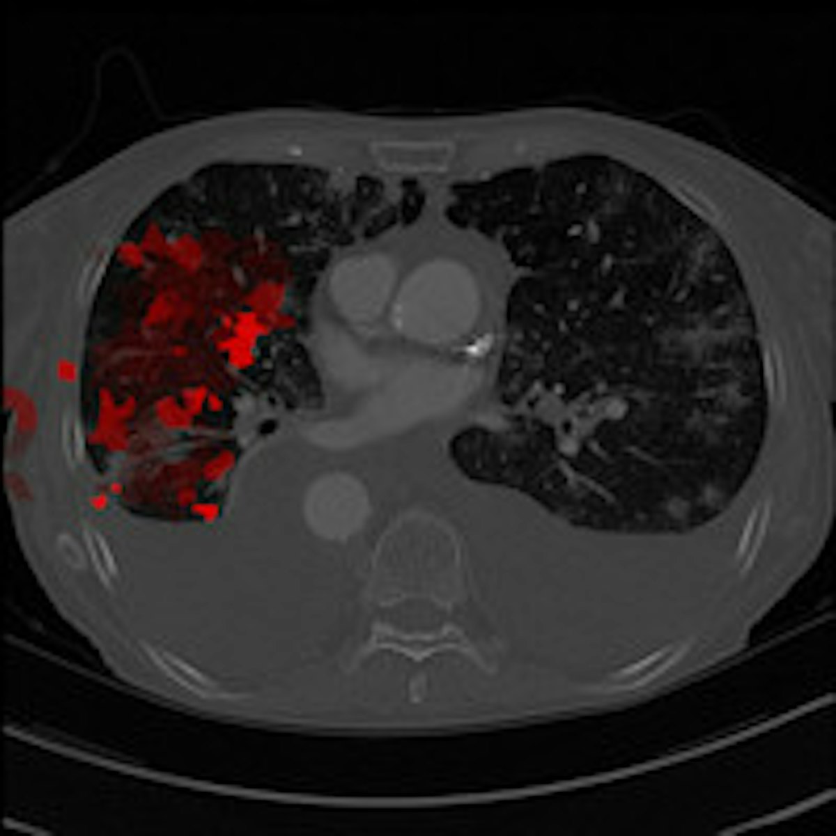 Specialist imaging search tool shows promise | AuntMinnieEurope