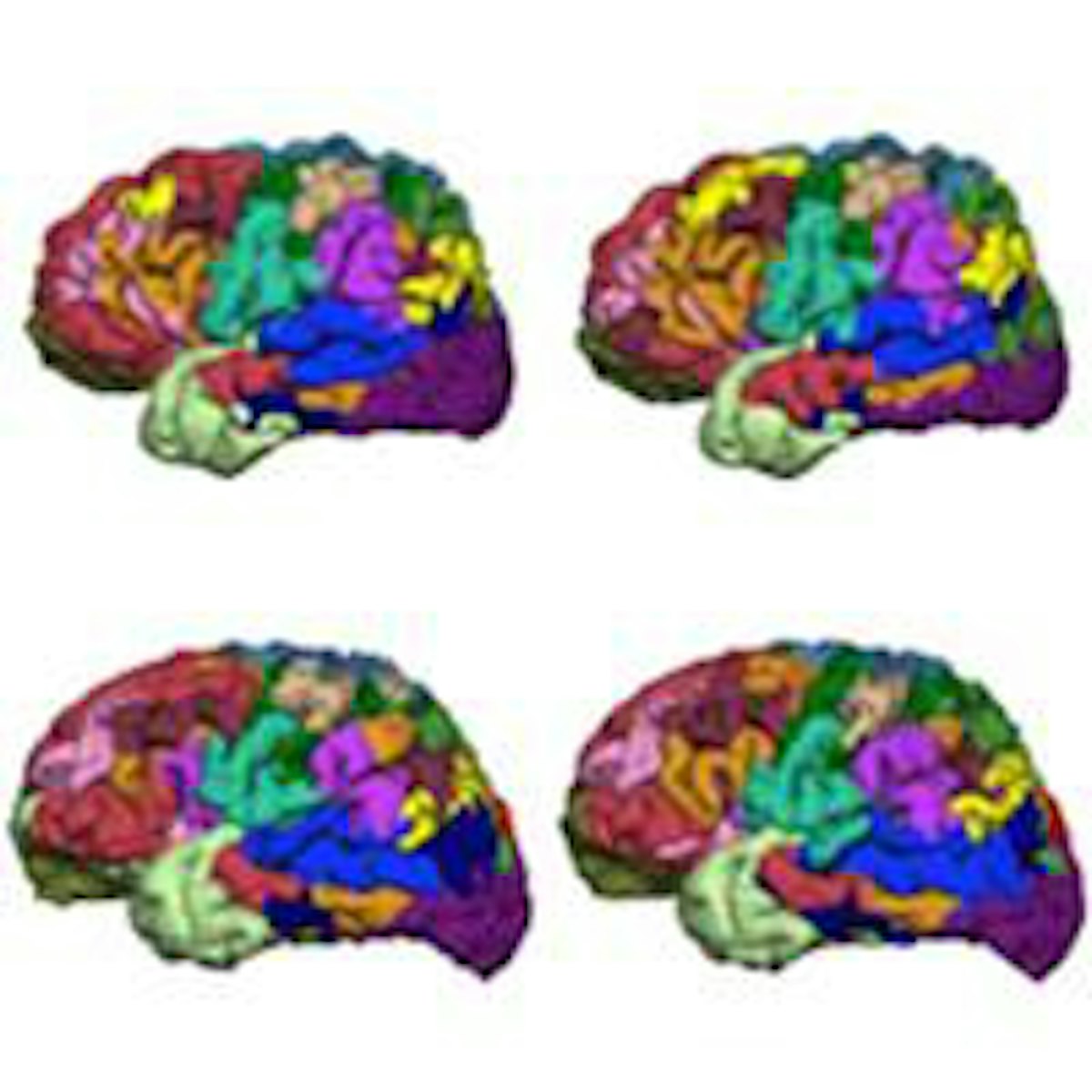 Functional MRI algorithm maps brain function | AuntMinnieEurope