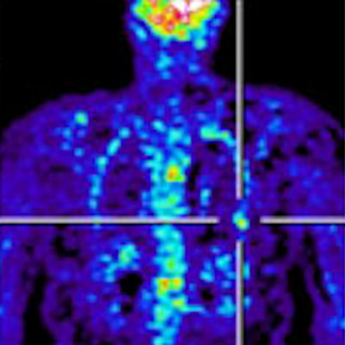 A clinical take on whole-body dynamic PET | AuntMinnieEurope