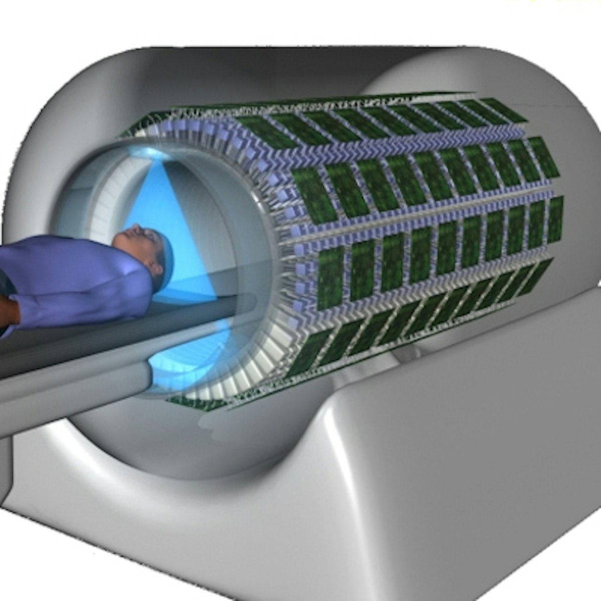 Simulations unveil potential of EXPLORER PET | AuntMinnieEurope