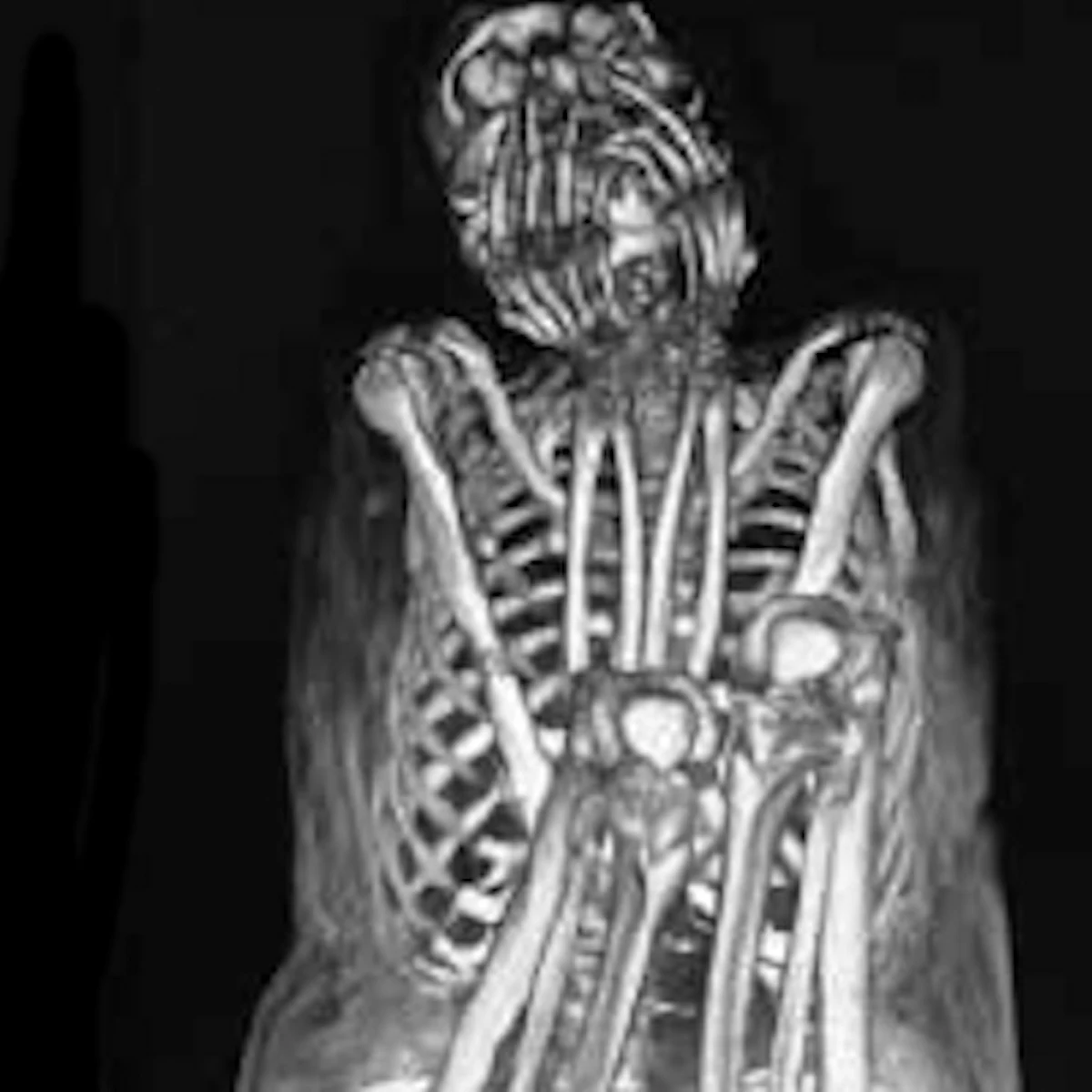 Radiology in Peru: From infectious diseases to mummies | AuntMinnieEurope