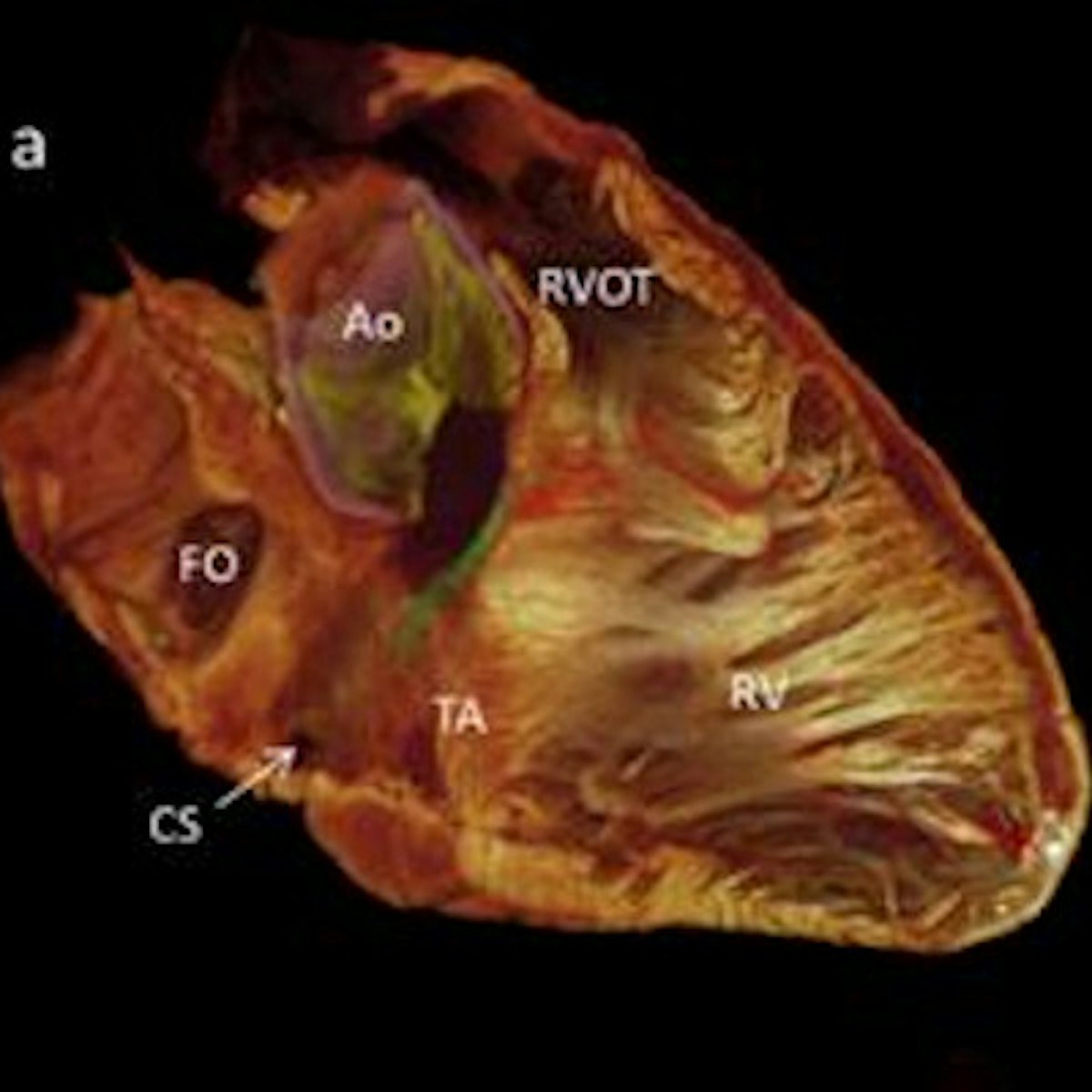 Researchers visualize cardiac conduction system in 3D | AuntMinnieEurope