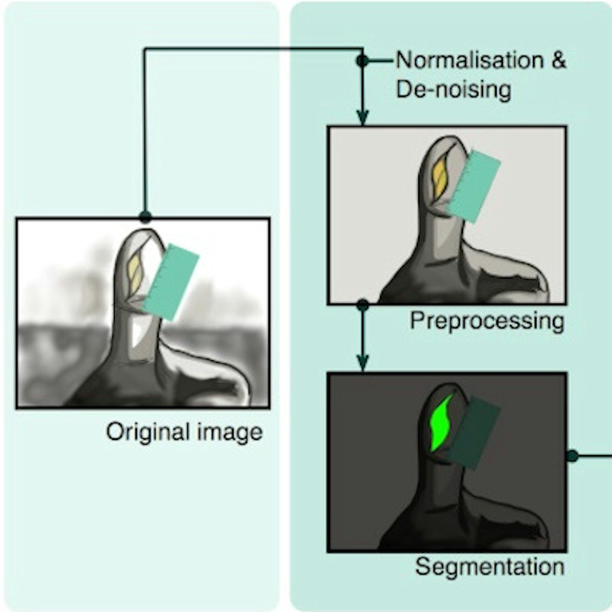 Image analysis with 3D modeling aids wound healing | AuntMinnieEurope