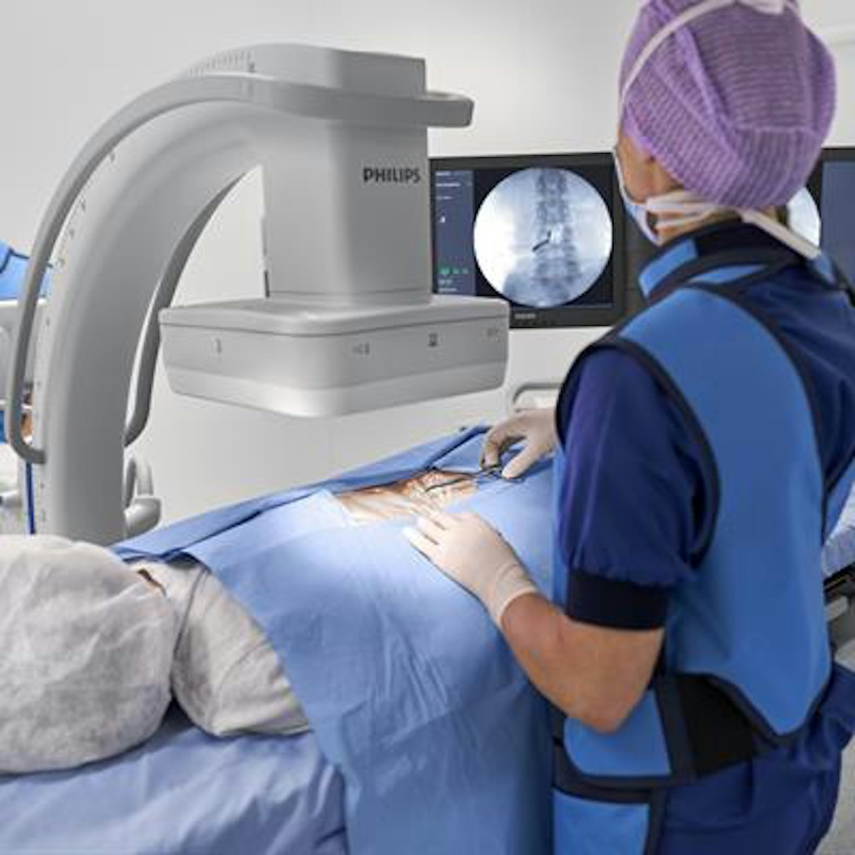 Philips launches new Zenition mobile C-arm | AuntMinnieEurope