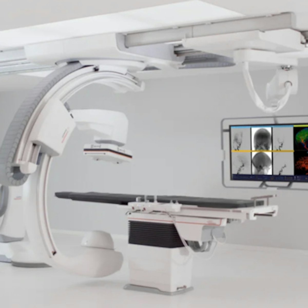 Siemens launches Artis icono angiography family at ECR | AuntMinnieEurope