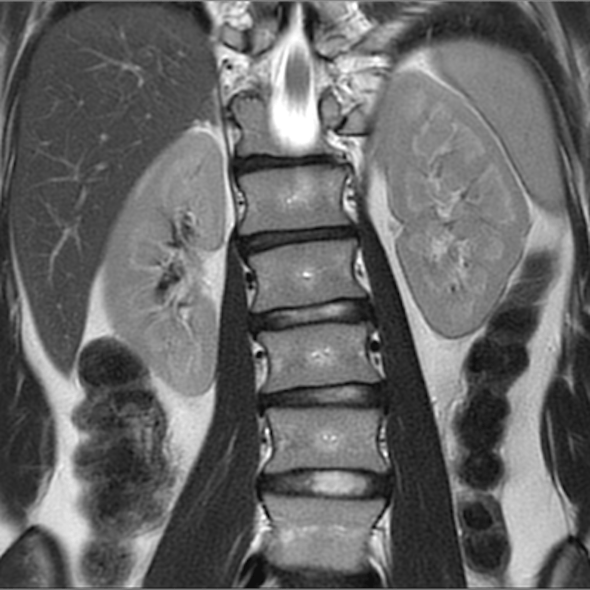 New MRI products target productivity and better outcomes | AuntMinnieEurope