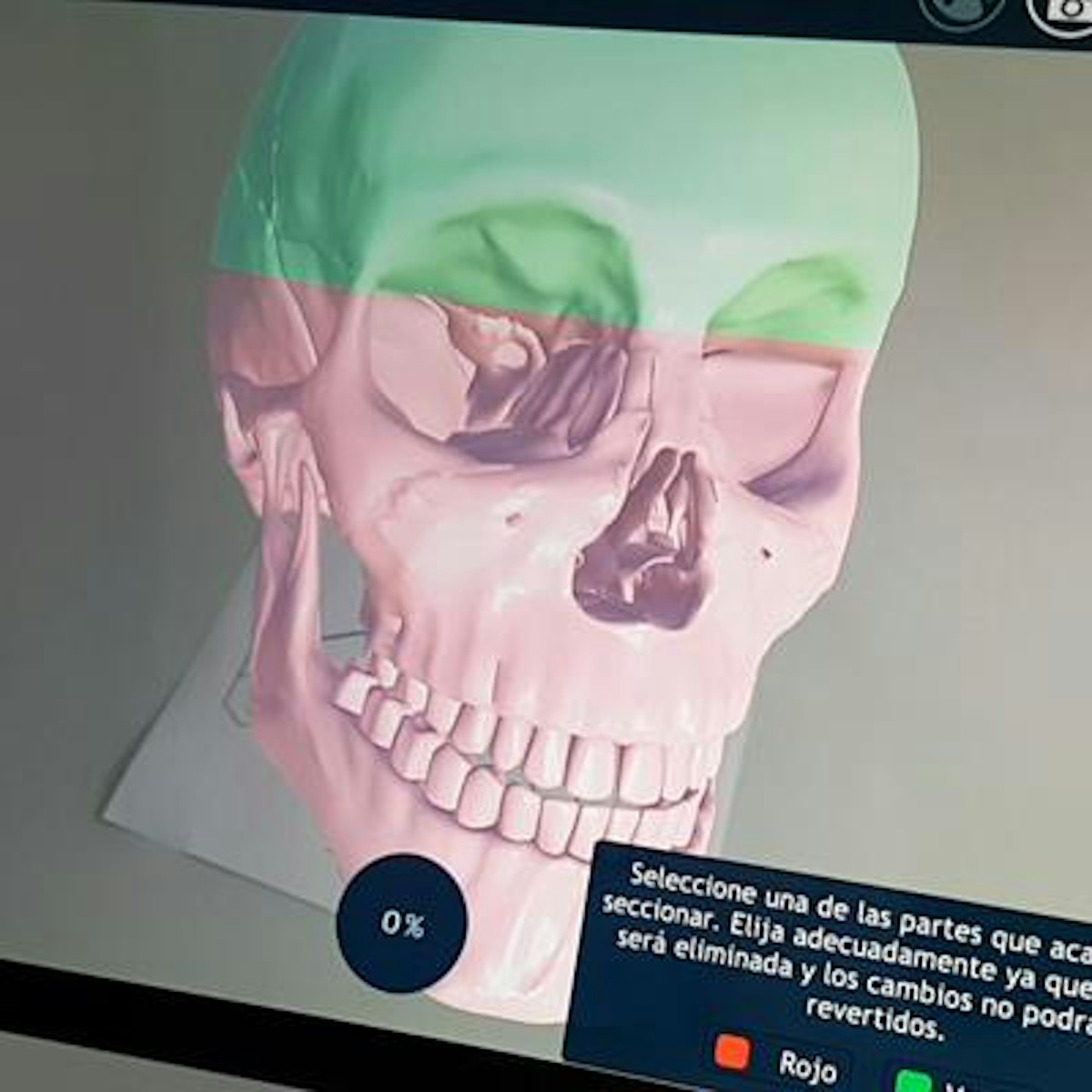 Spanish offer new approach to 3D brain visualization | AuntMinnieEurope