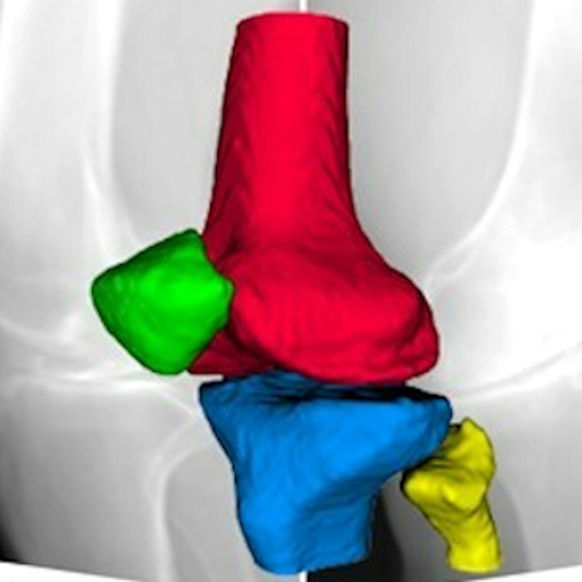 RSIP Vision develops AI module for 3D knee x-ray | AuntMinnieEurope