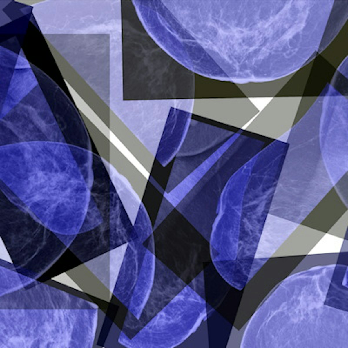 AMRA highlights body composition analysis research | AuntMinnieEurope