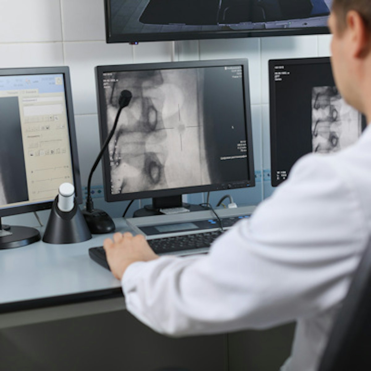 Barco releases new medical display controllers | AuntMinnieEurope