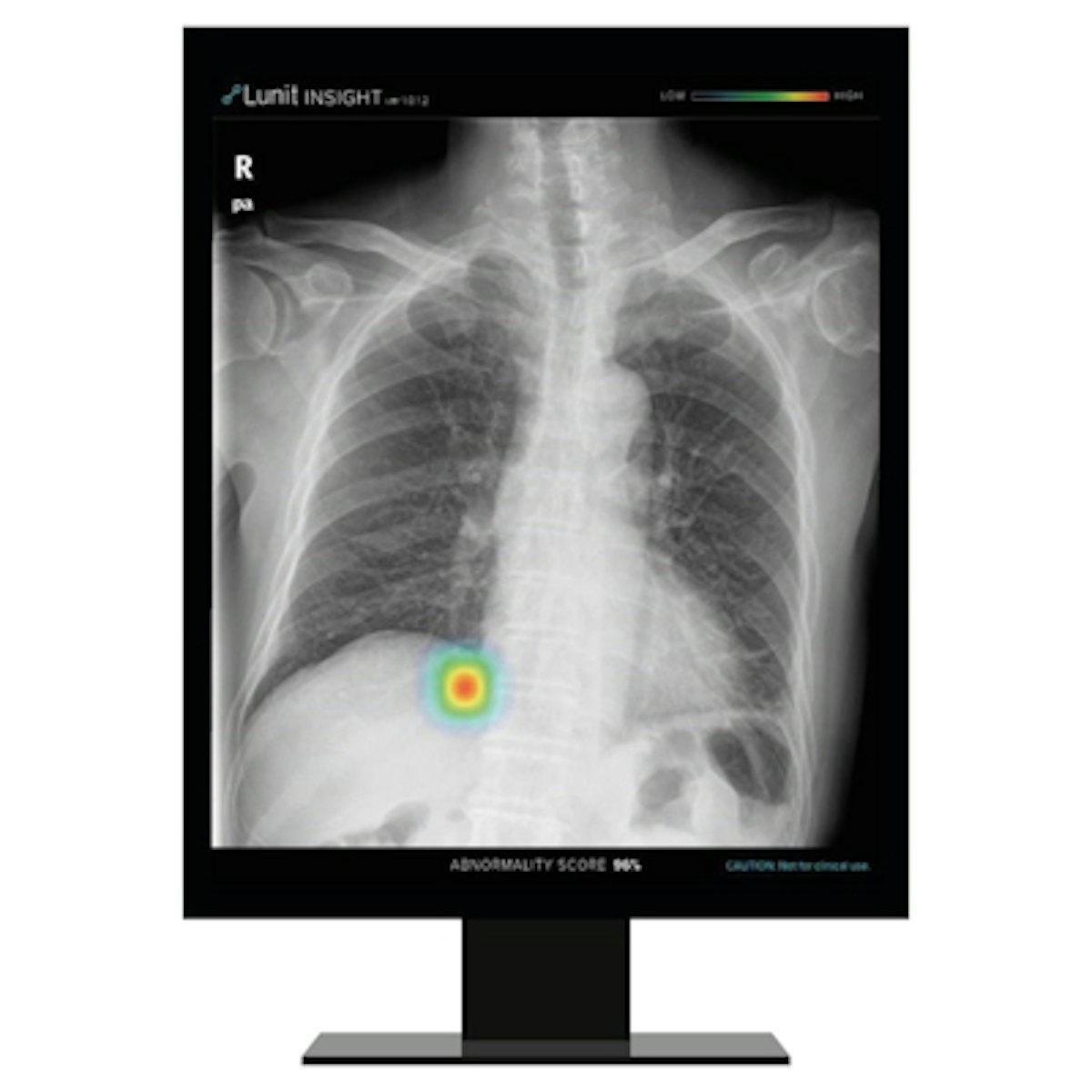 Lunit partners with Philips on chest AI software | AuntMinnieEurope