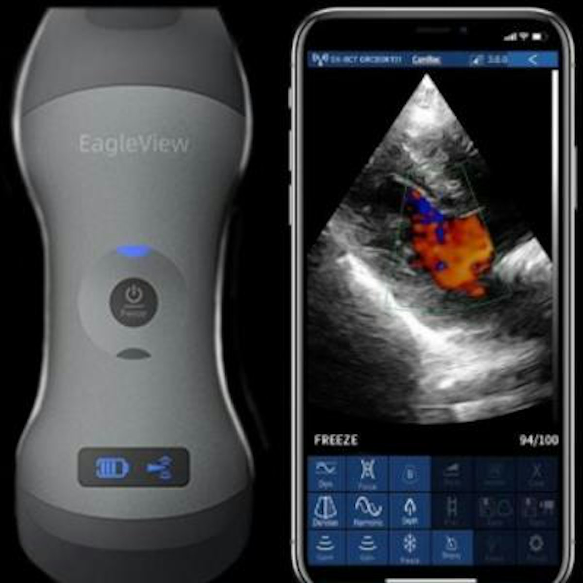 EagleView releases POCUS device | AuntMinnieEurope