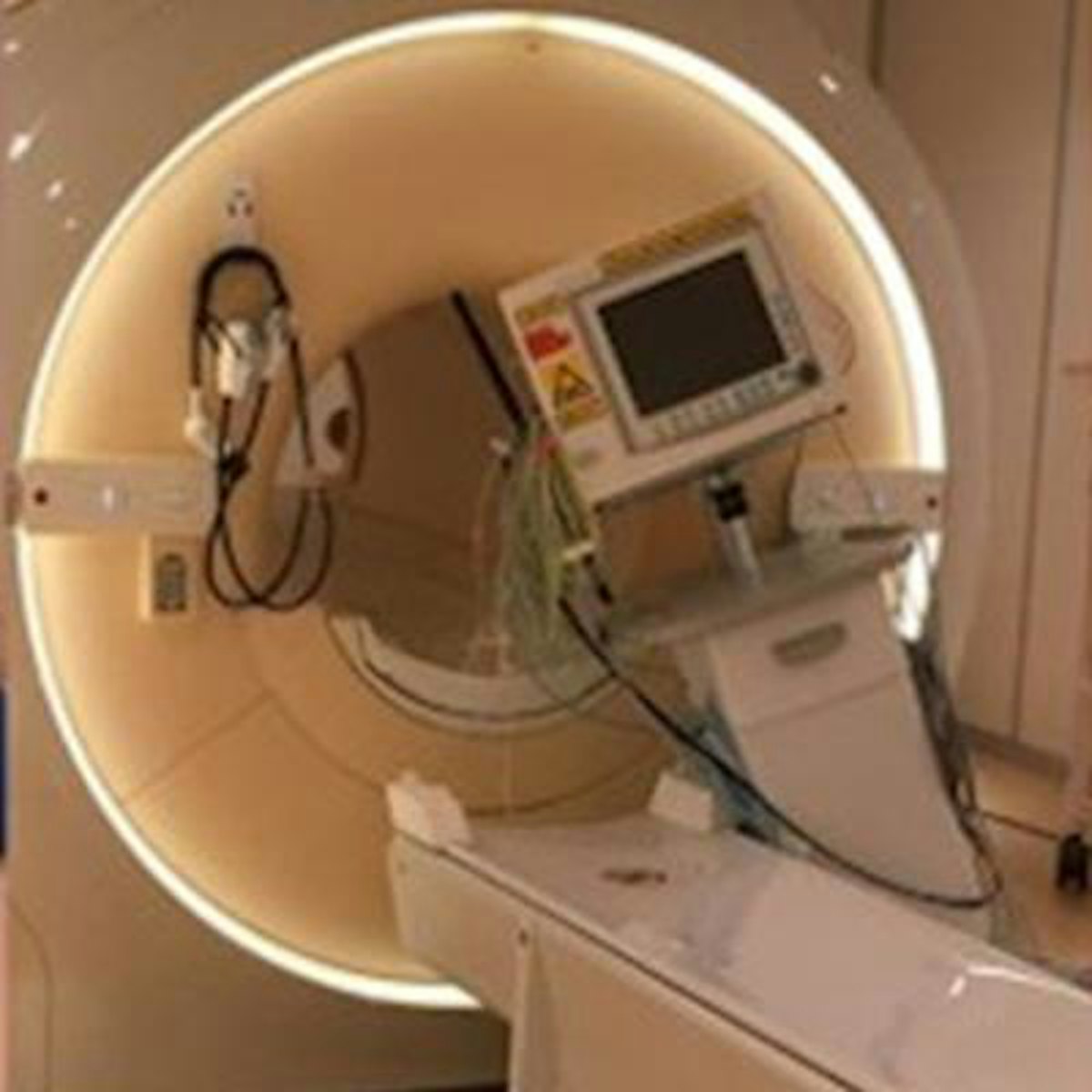 Report emerges of second serious global MRI accident | AuntMinnieEurope
