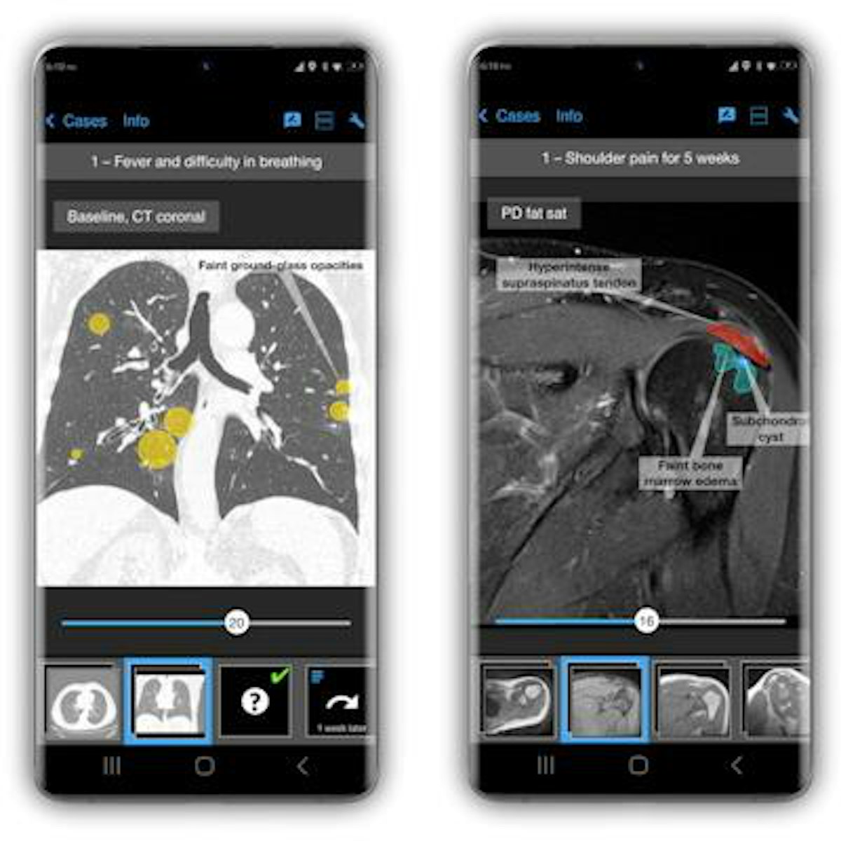 COVID-19 and MSK training app launches Android version | AuntMinnieEurope