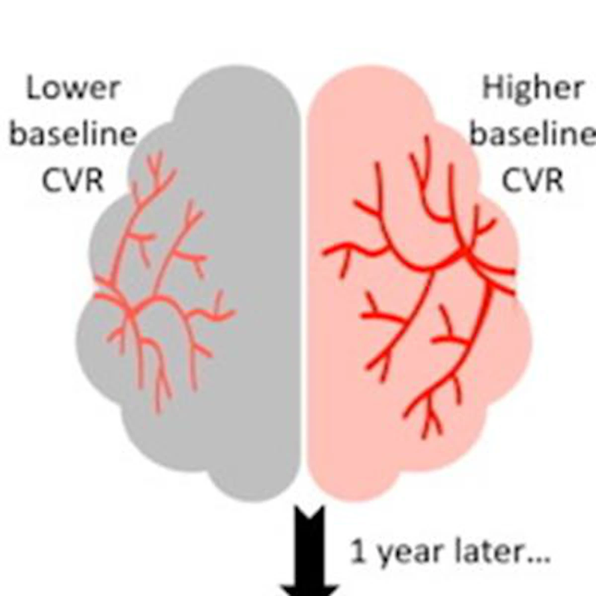 MRI links CVR reactivity to small-vessel disease in stroke patients ...