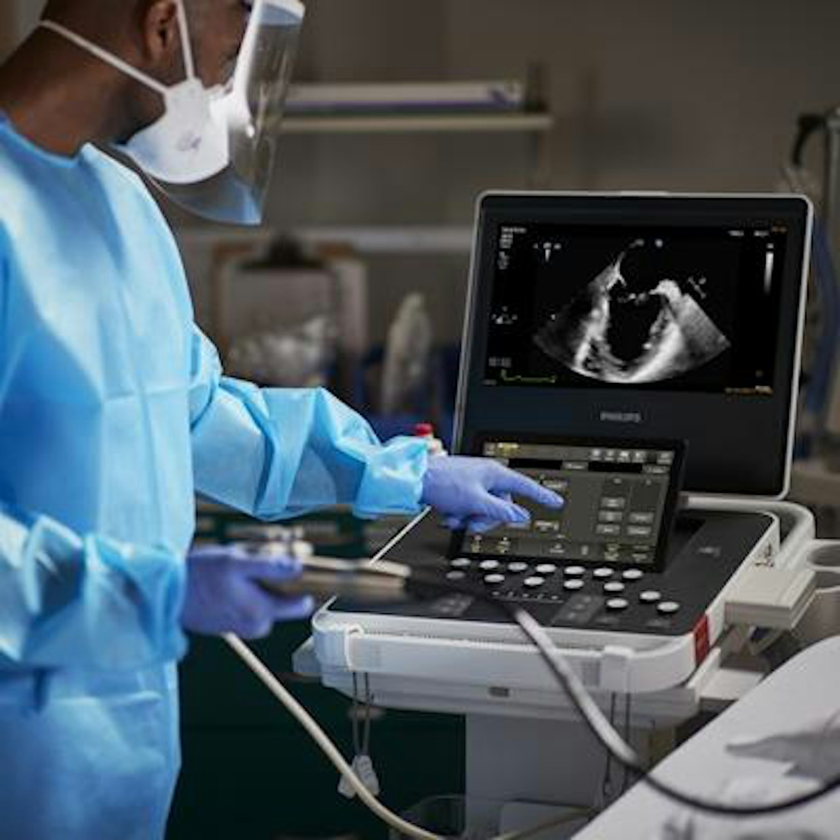 Philips reveals plans for portable ultrasound unit | AuntMinnieEurope
