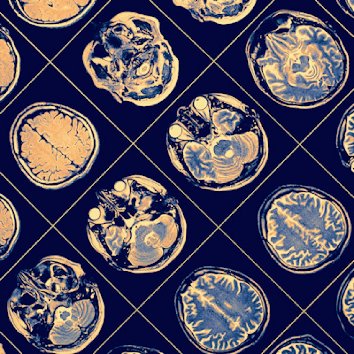 Study supports use of copper in MRI contrast agents | AuntMinnieEurope