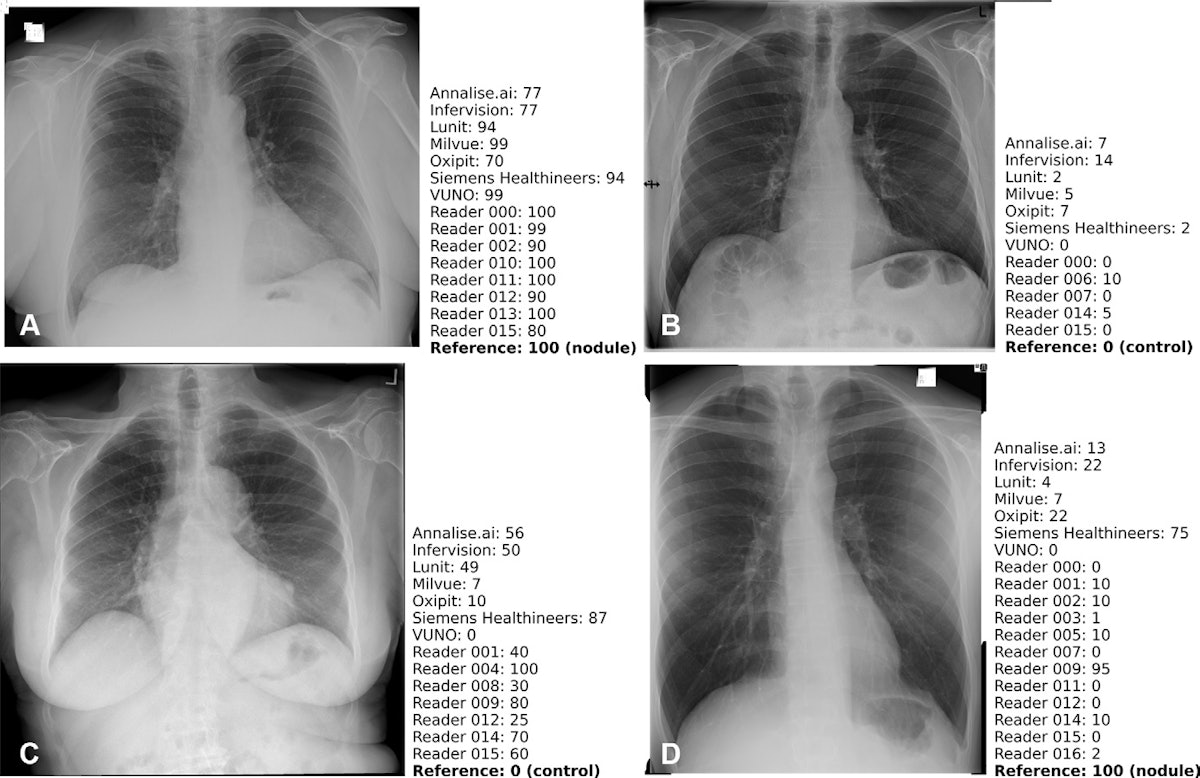 Radiologists in Europe ramp up testing of AI | AuntMinnieEurope
