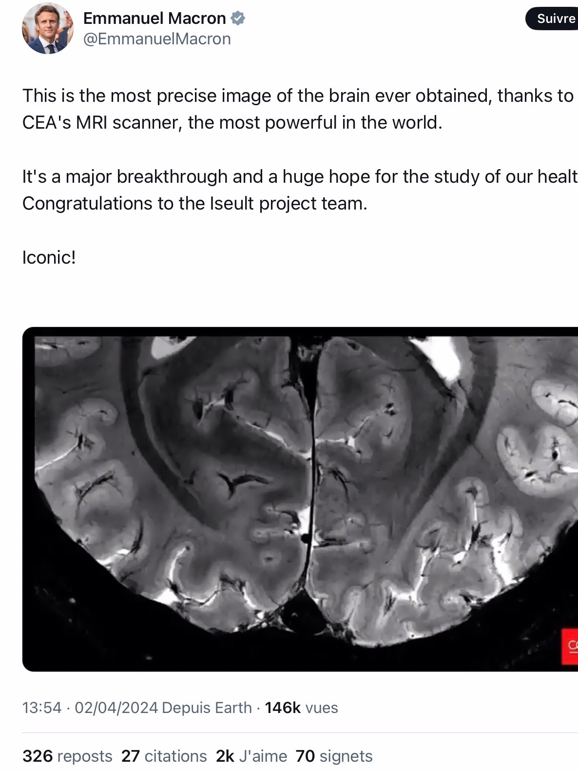 French-led team unveils 11.7 tesla MRI scans of human brain ...