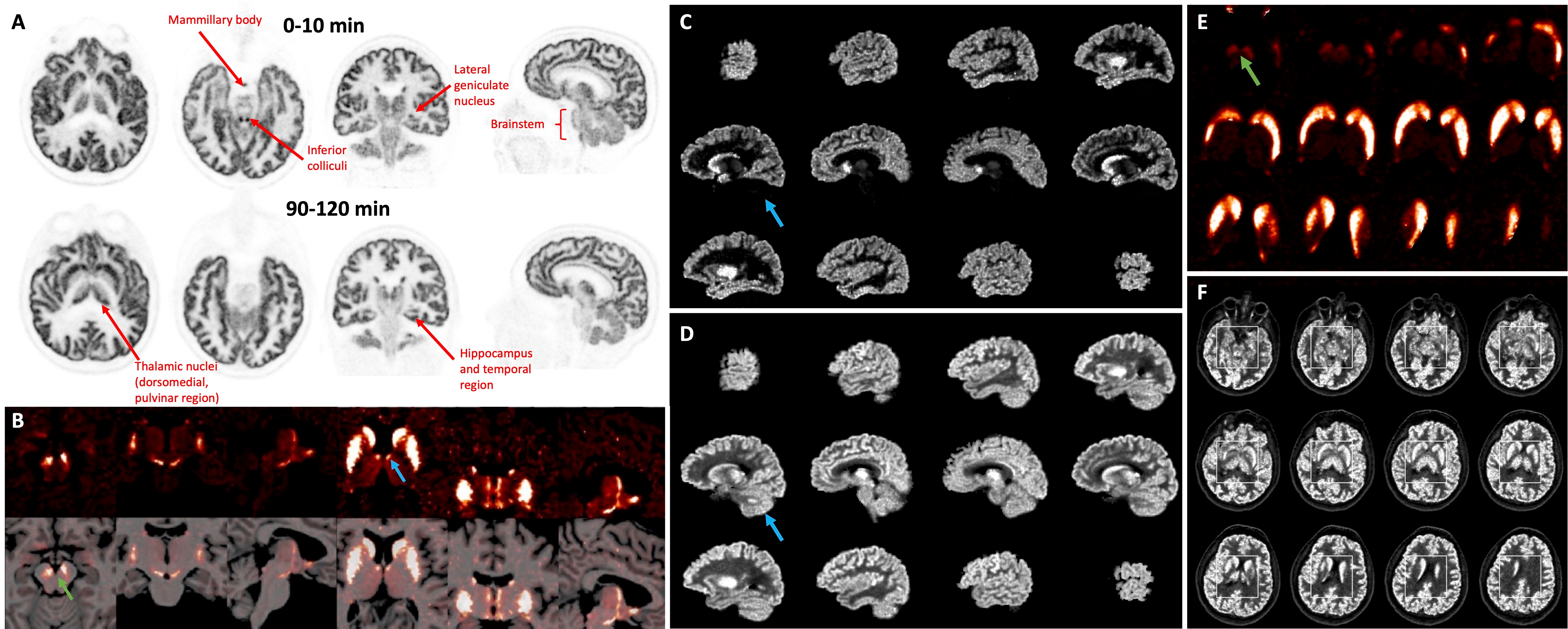Image of the Year shows early brain nuclei activity | AuntMinnieEurope