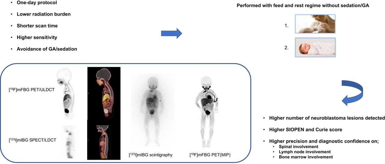 LAFOV PET/CT feasible in infants with neuroblastoma | AuntMinnieEurope