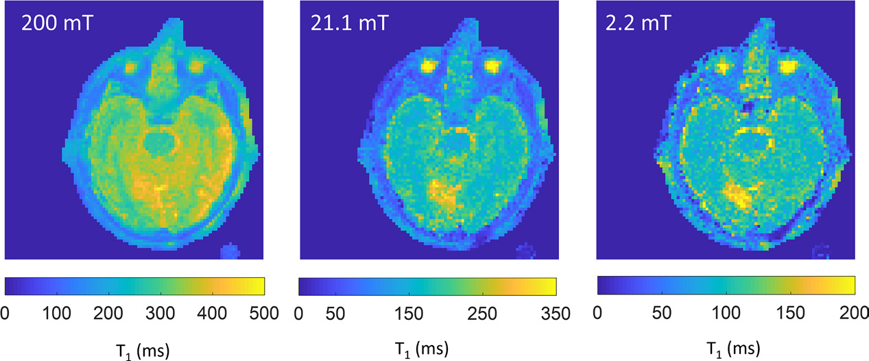 'Field-cycling' MRI identifies subacute stroke at low field strengths ...