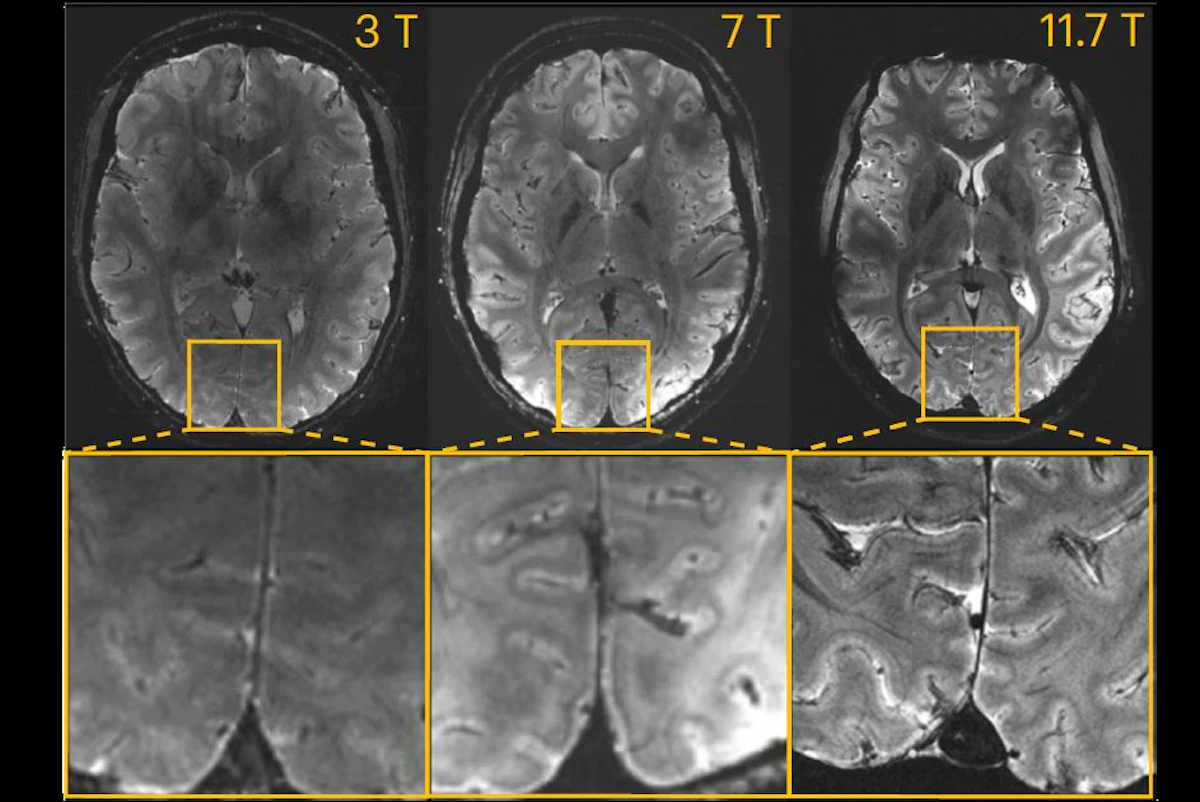 French group casts light on safety of 11.7T MRI | AuntMinnieEurope