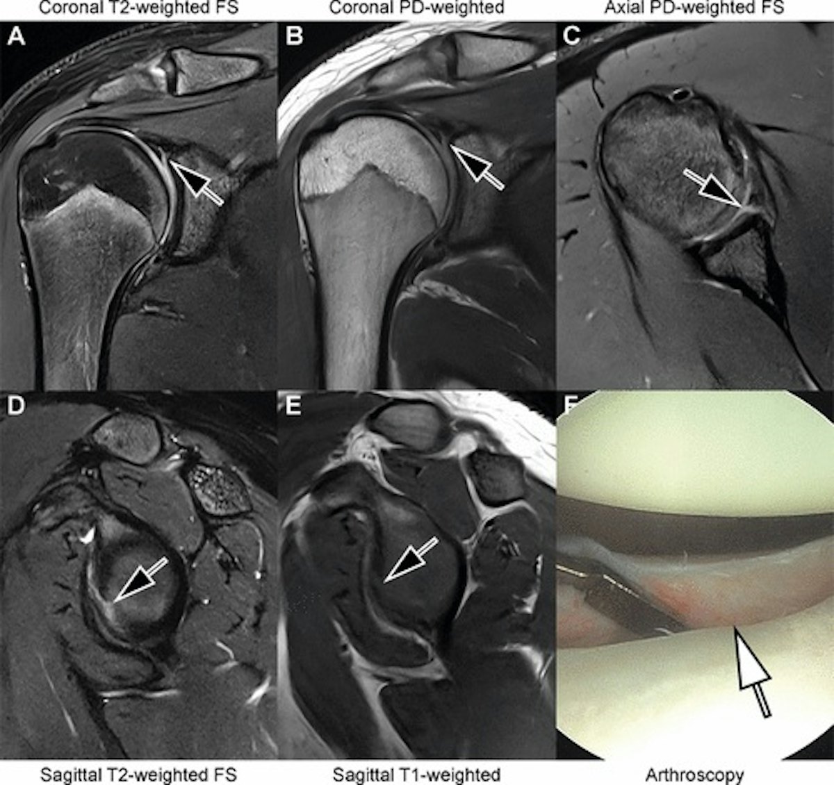 7-minute shoulder MRI scans prove feasible | AuntMinnieEurope