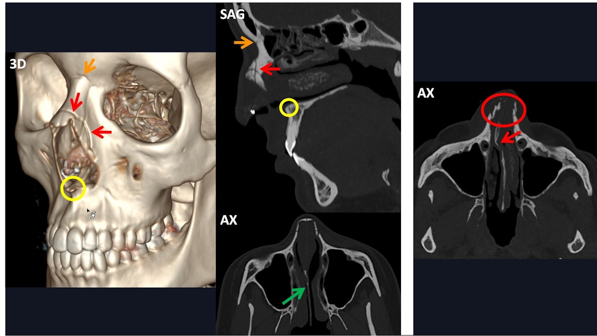 sagittal ct view