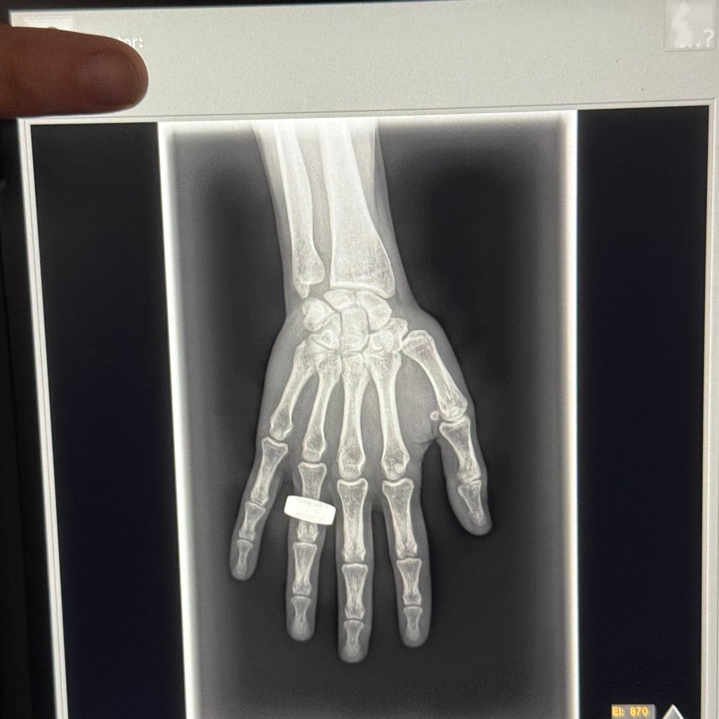 Is this the first x-ray image taken in space? | AuntMinnieEurope