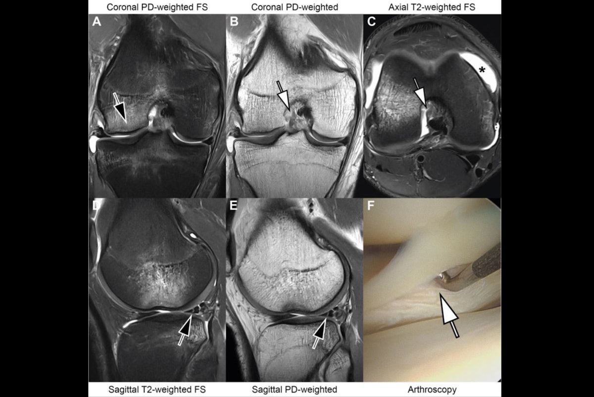 mri master knee coronal