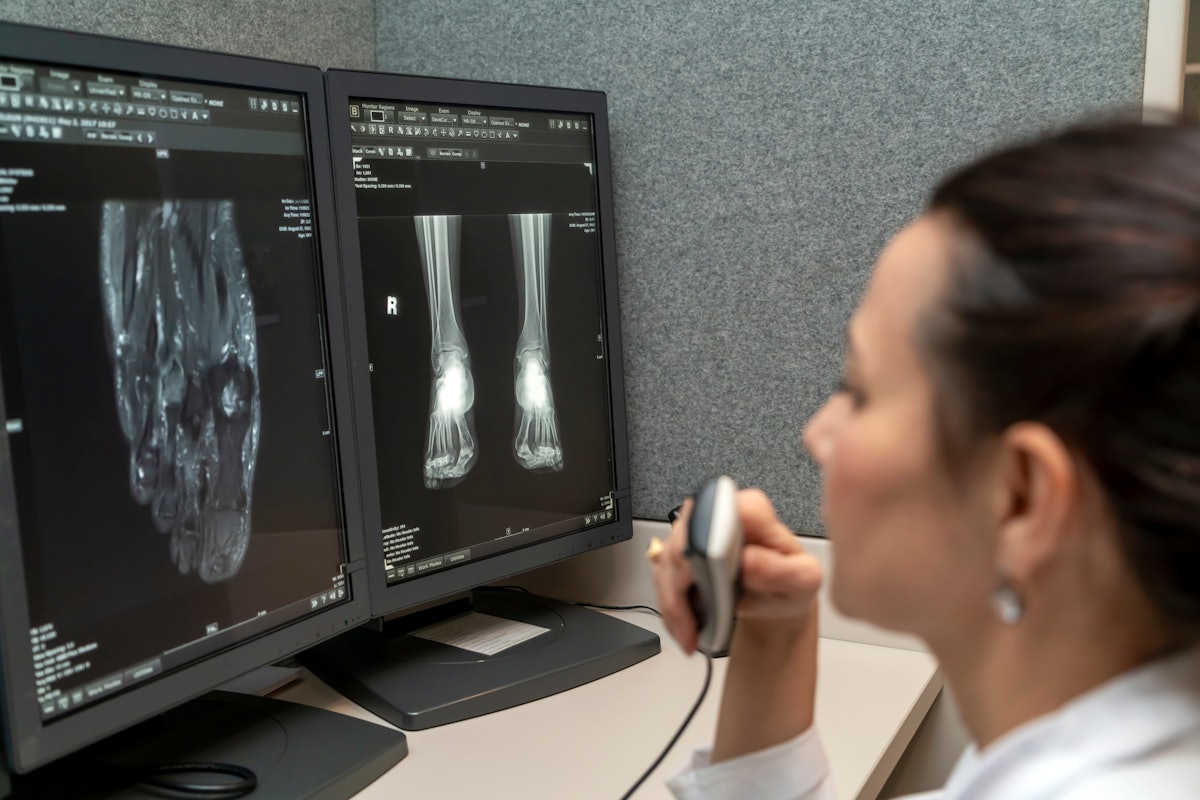 KA Imaging gets CE Mark for mobile x-ray system | AuntMinnieEurope