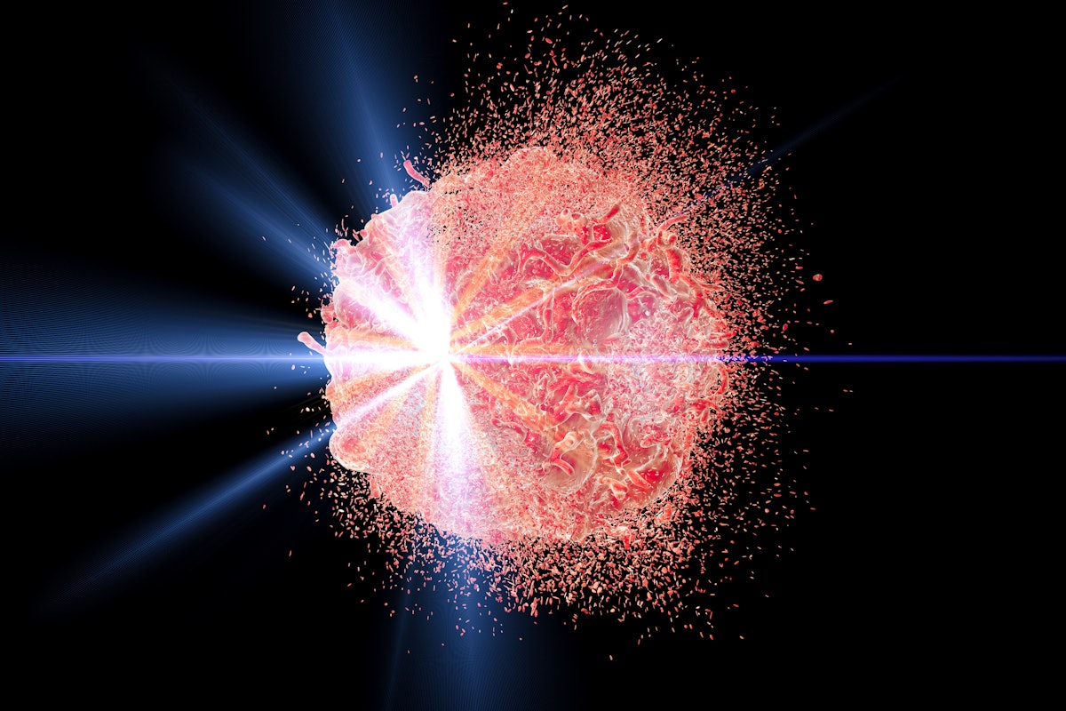 U.K. group releases radiotherapy safety guidances | AuntMinnieEurope