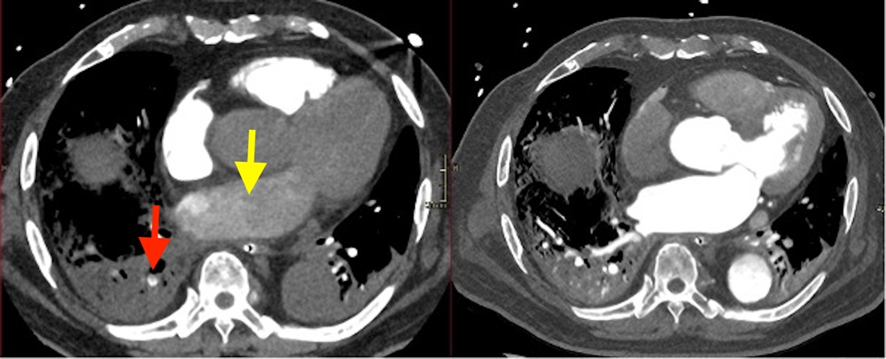 Stay sharp to avoid pitfalls of emergency imaging in elderly ...
