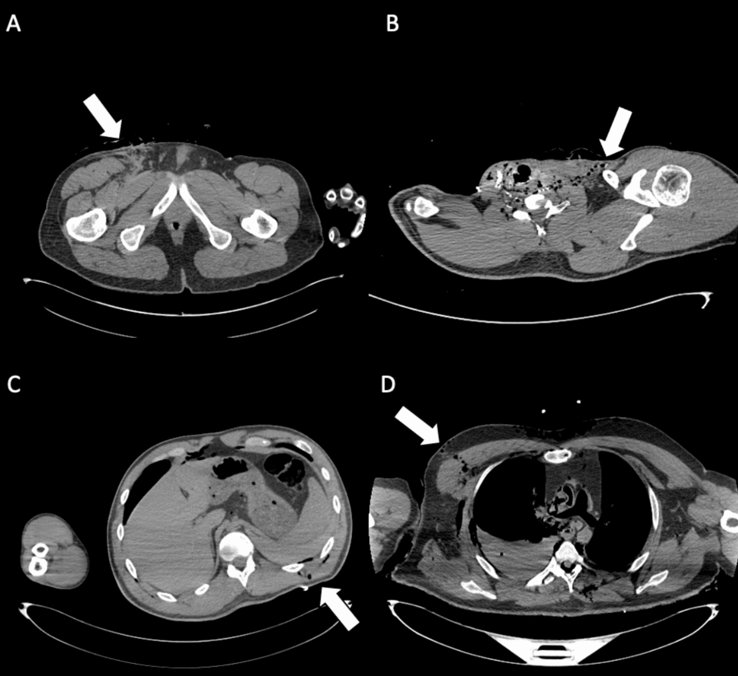 Team Sicily shines light on imaging of gunshot wounds | AuntMinnieEurope