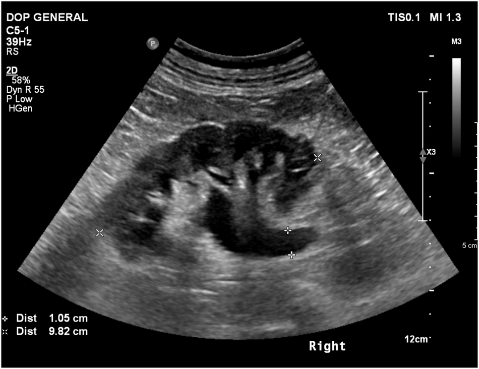Doubts cast on clinical readiness of ChatGPT-5 | AuntMinnieEurope